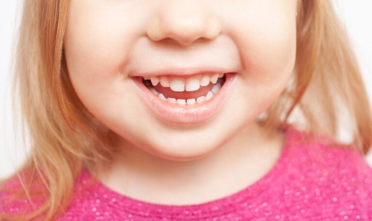 8 year old not losing her milk teeth. Is it normal?